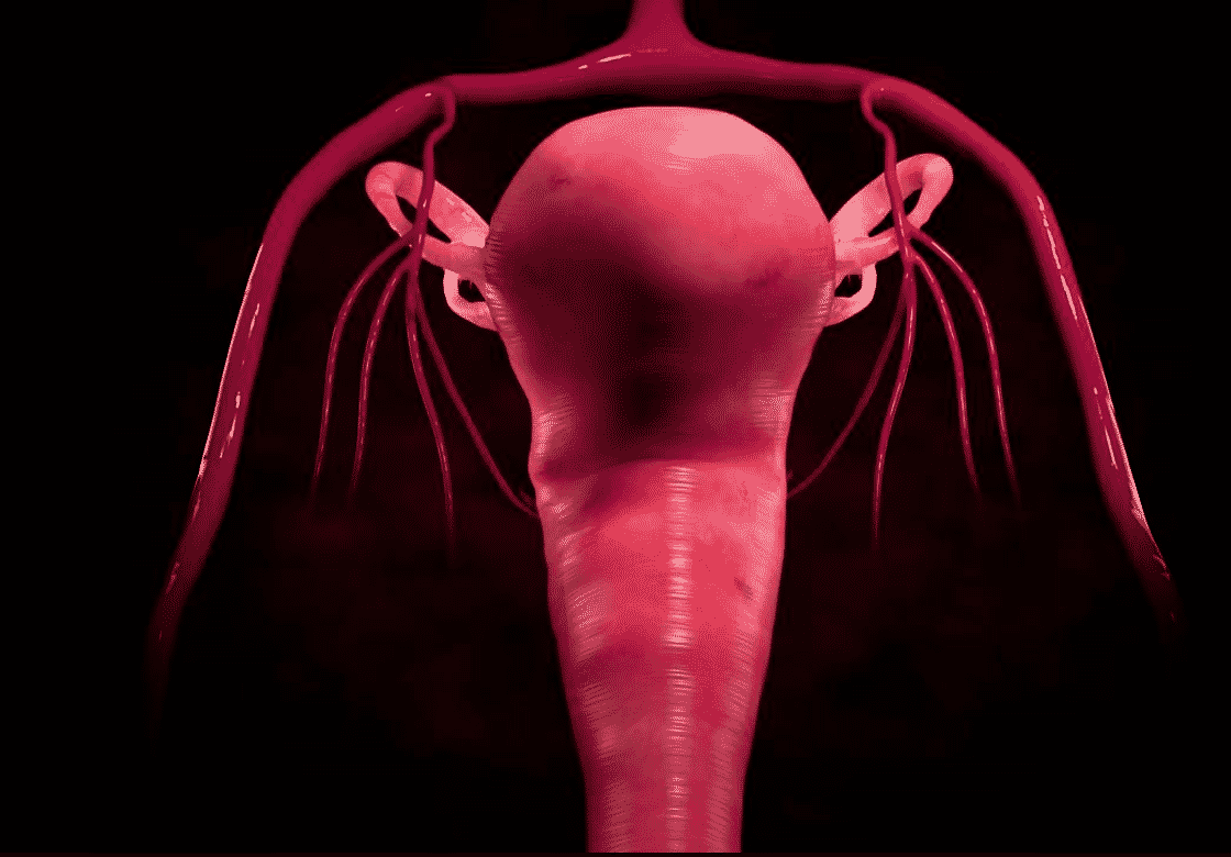 Uterine Fibroid Artery Embolization Specialist Uae Ufe